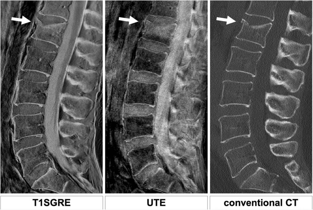 Une séquence IRM concordante avec le scanner pour l’exploration des ...