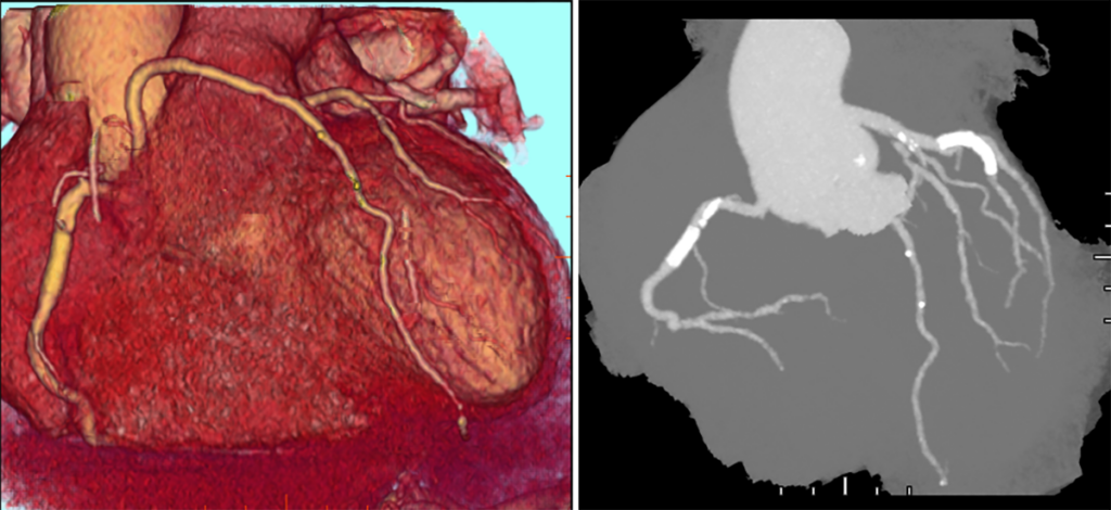 Les indications et les techniques du scanner cardiaque - Docteur Imago