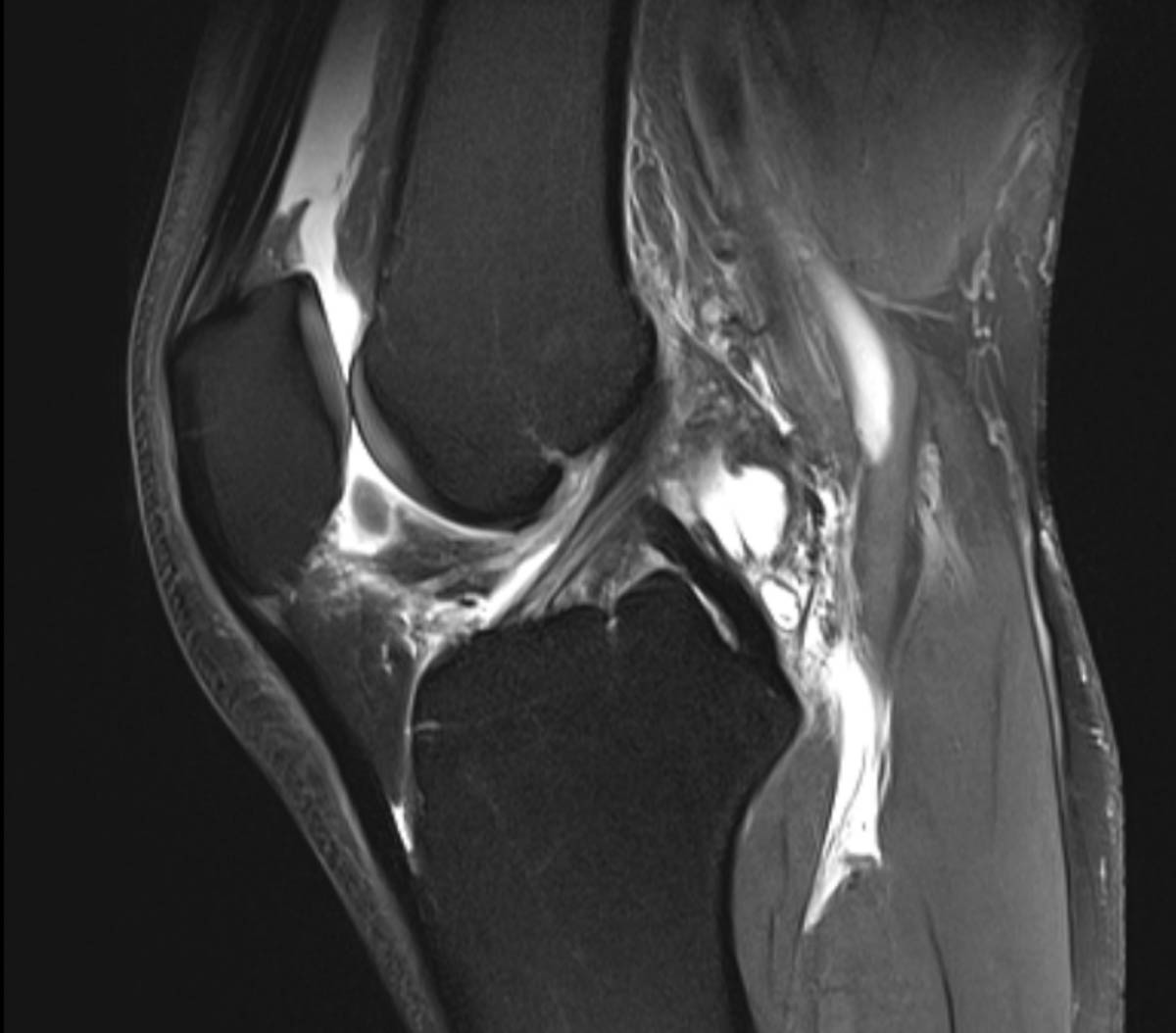 Une aide au diagnostic pour l’IRM du genou - Docteur Imago