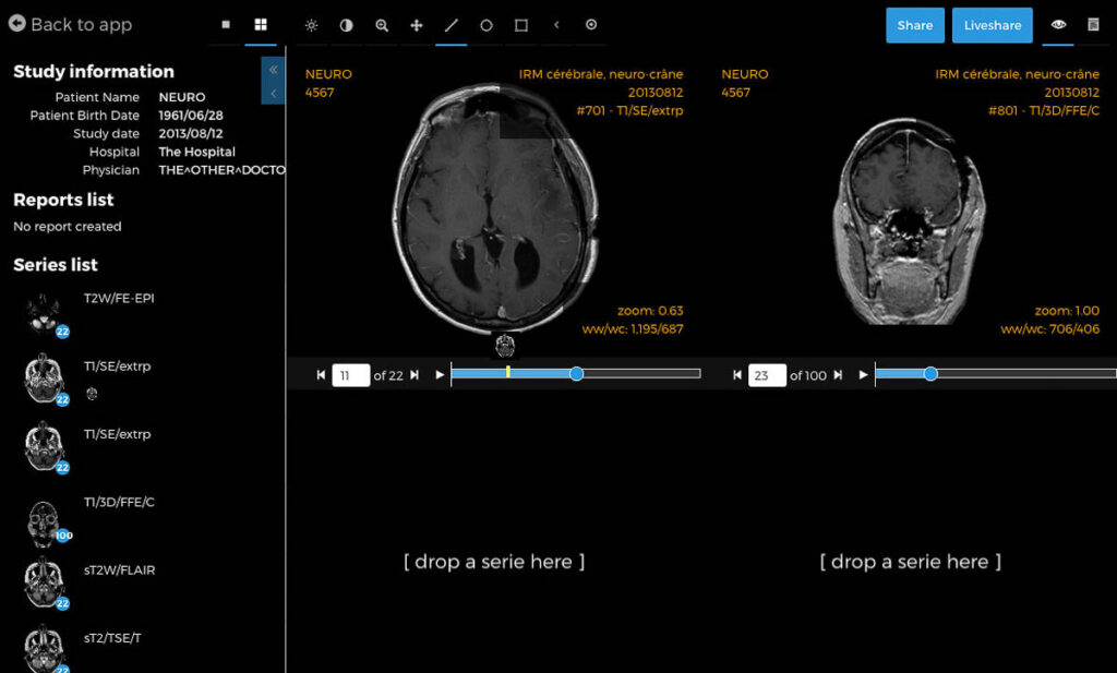 Des solutions logicielles pour faciliter le transfert d’images ...