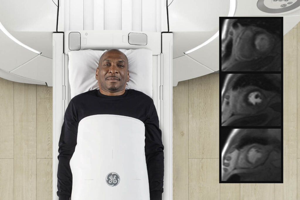 GE Healthcare lance son nouveau produit de contraste en IRM - Docteur Imago