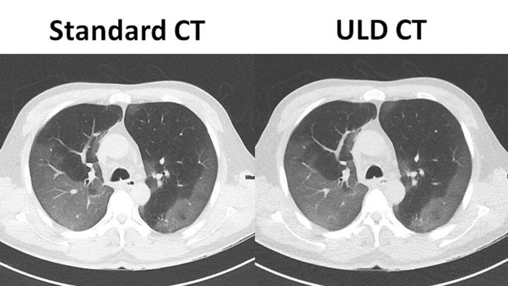 Le scanner ultra low dose supplante la radiographie à Nîmes - Docteur Imago