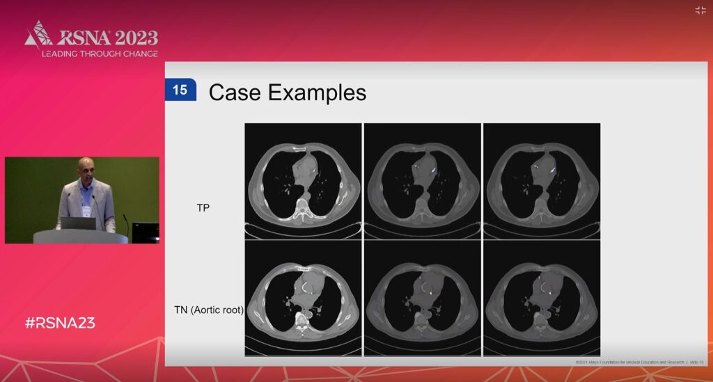 L’importance du score calcique et comment l’évaluer de façon ...