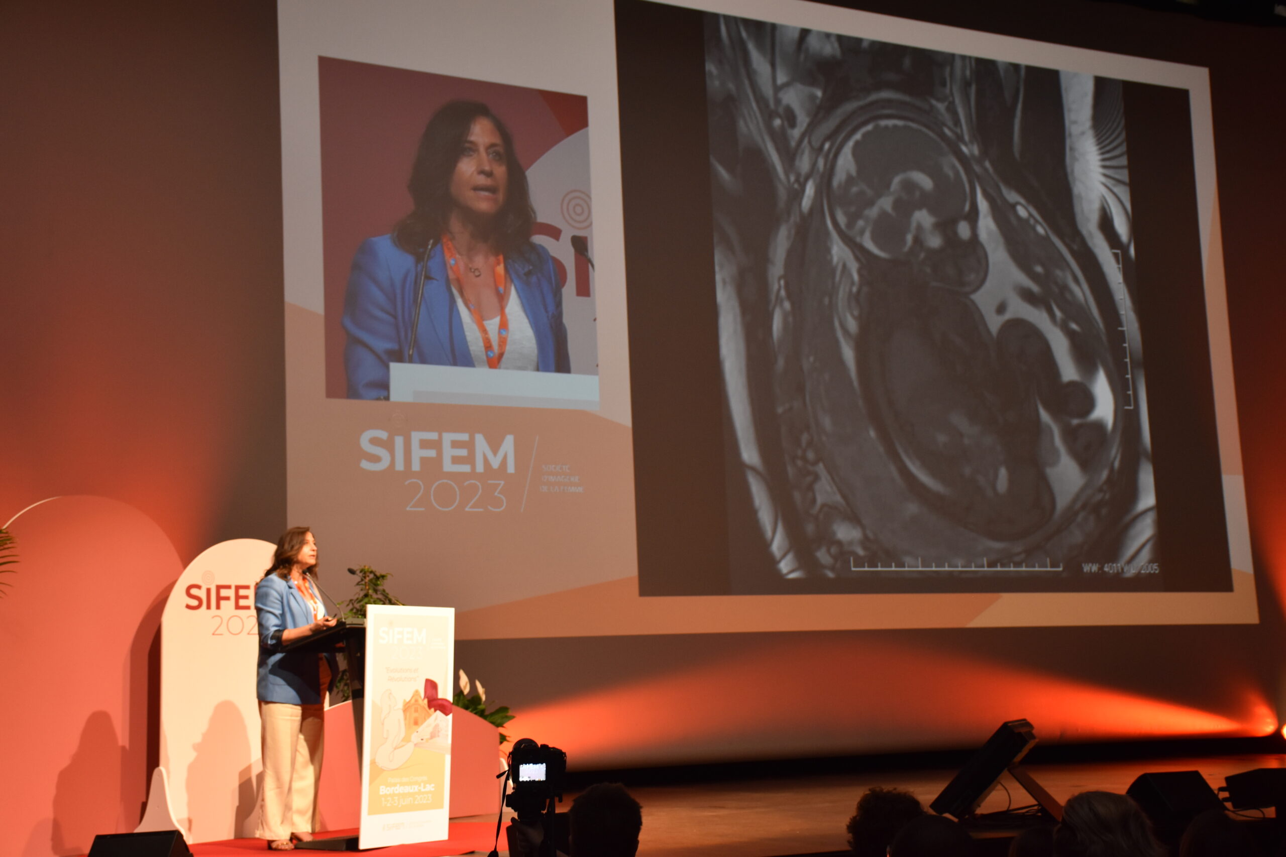 Quelles sont les conséquences de l'IRM fœtale chez la femme enceinte ? - Tech Imago