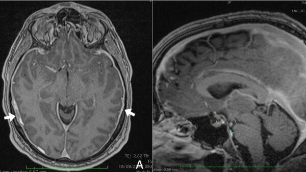 Formation - Tech Imago